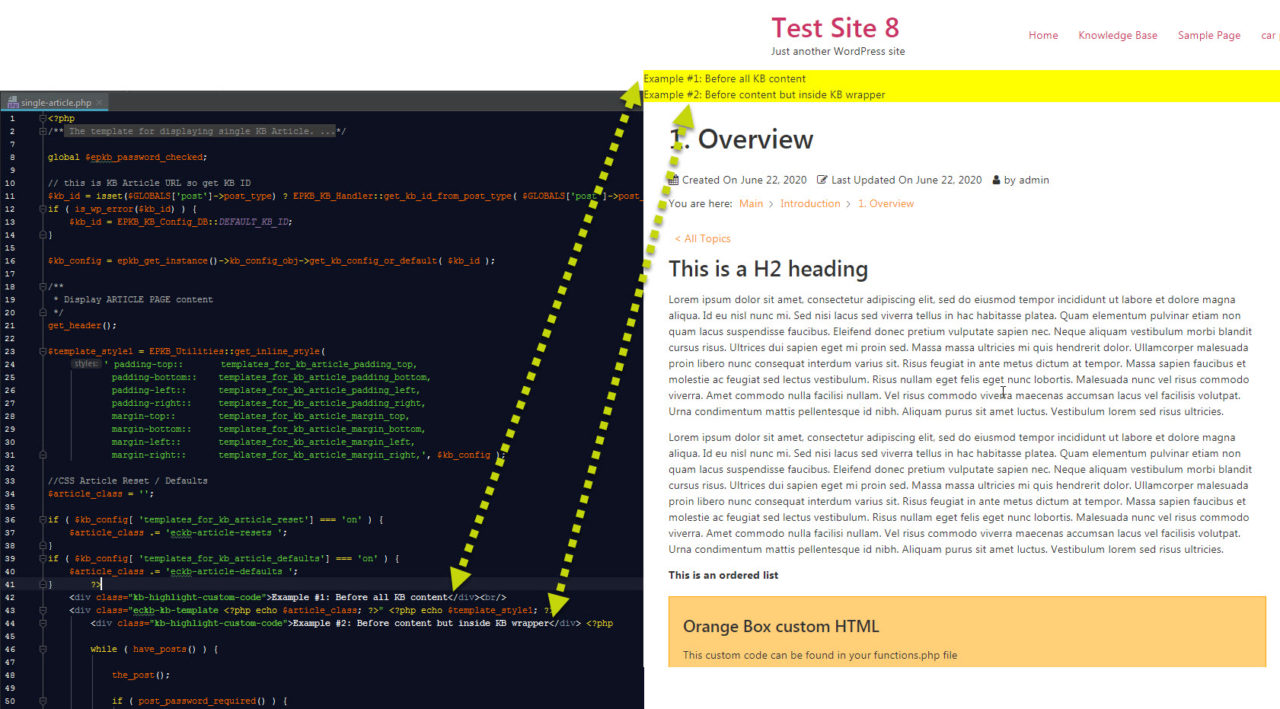 Creating Custom Articles - Echo Knowledge Base